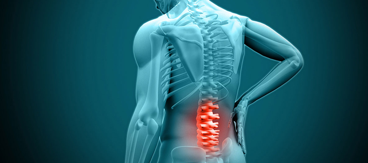 Relief Without Surgery By Non Invasive Spinal Decompression